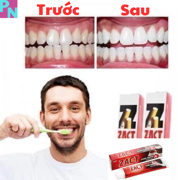 Kem đánh răng Zact 190g danh cho người dùng trà cafe thuốc lá - Lion Nhật Bản | Lazada.vn