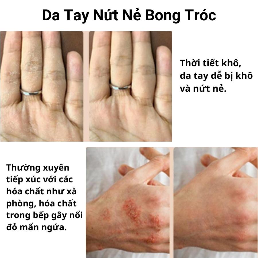 Kem dưỡng da tay Seomou Kem dưỡng tay mền mịn chiết xuất từ thiên nhiên ...