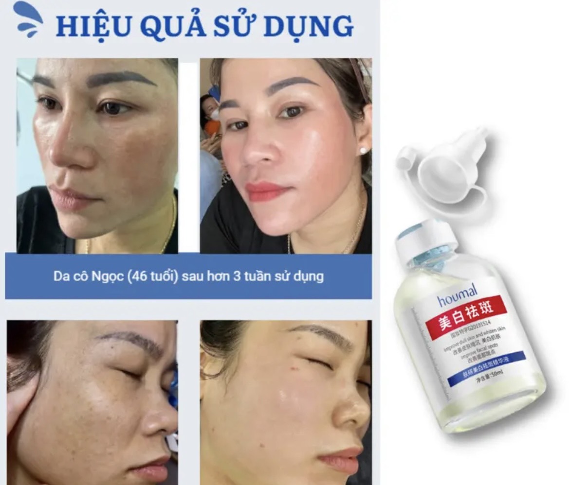 Tinh chất hút nám tàn nhang đồi mồi HOUMAL serum dưỡng da chống lão hóa ...